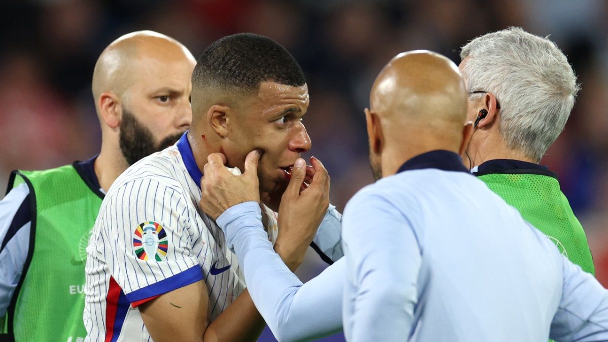 EUROで鼻負傷のエムバペ、「マスクのアイデアある？（冷や汗）」とSNSに投稿 | TRILL【トリル】