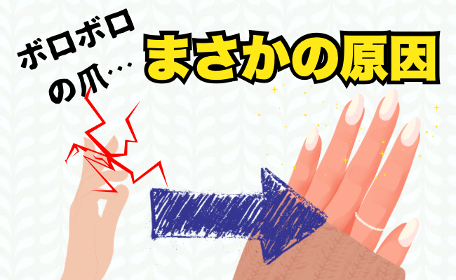 40代、爪がボロボロに…割れやすくなった爪を守るためにおこなったことは【体験談】 | TRILL【トリル】
