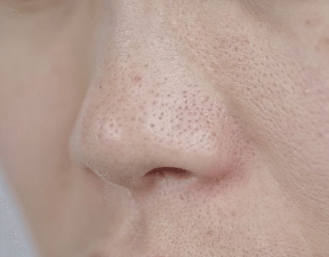 「かえって毛穴を目立たせているかも」→プロが教える！毛穴を強調する『5つのNGメイク』とは？ | TRILL【トリル】