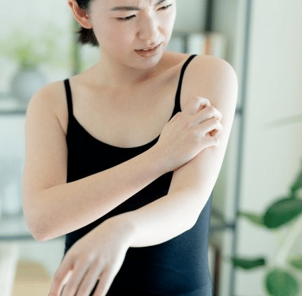 医師「やらないで」 蚊に刺された後に注意して→やってはいけない“NG行動”とは【医師の監修】 | TRILL【トリル】